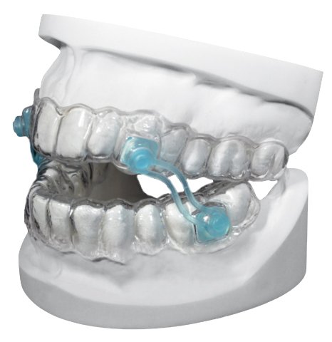 Silensor SL hilft Schnarchpatienten - 80 % Erfolgsbilanz